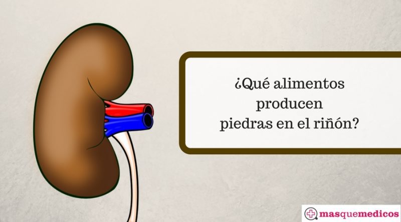 ¿Qué alimentos producen piedras en el riñón? - Blog de Masquemedicos