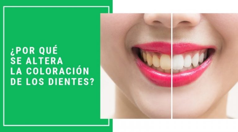 ¿Por qué se altera la coloración de los dientes? - Blog de Masquemedicos