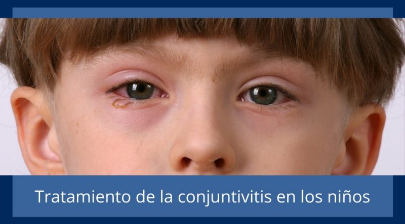Tratamiento de la conjuntivitis en los niños - Blog de Masquemedicos