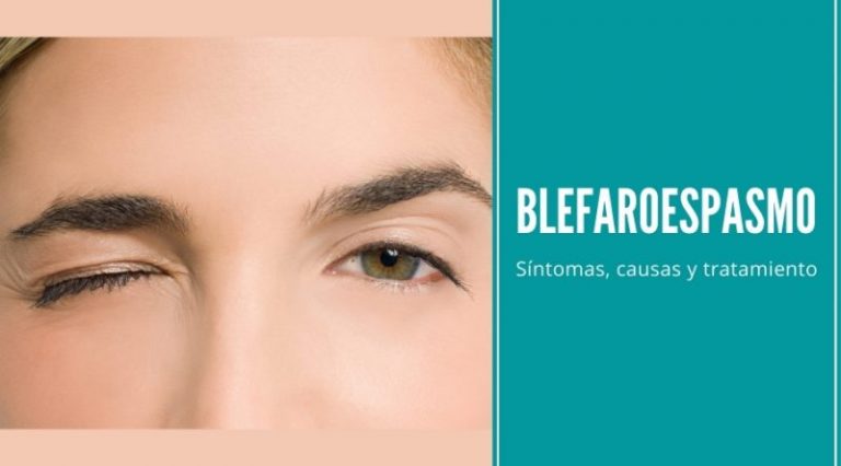 Blefaroespasmo. Síntomas, causas y tratamiento - MQM
