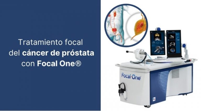 Tratamiento focal del cáncer de próstata con Focal One® - MQM