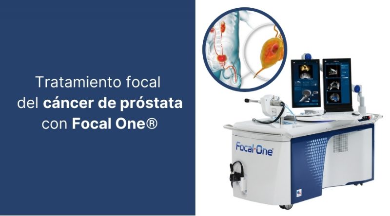 Tratamiento focal del cáncer de próstata con Focal One® - MQM