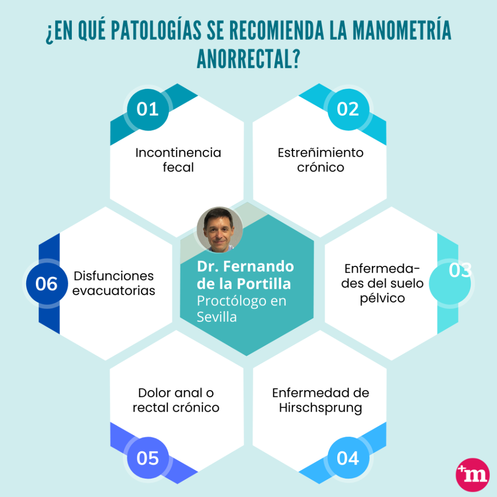 Manometría anorrectal: en qué consiste - Blog de Masquemedicos