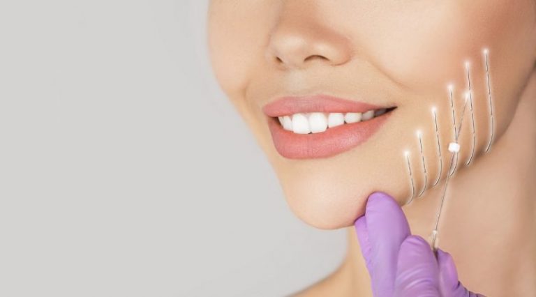 Hilos tensores en la cara: precio y duración - Blog de Masquemedicos